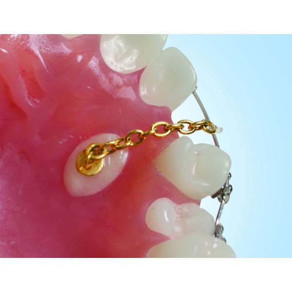 Eruption Appliance (3878)