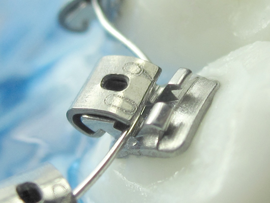 Evolution SLT - CNC Milled (20925)