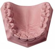 Snap Stone Type IV 25/Lb Pink FS (10269)