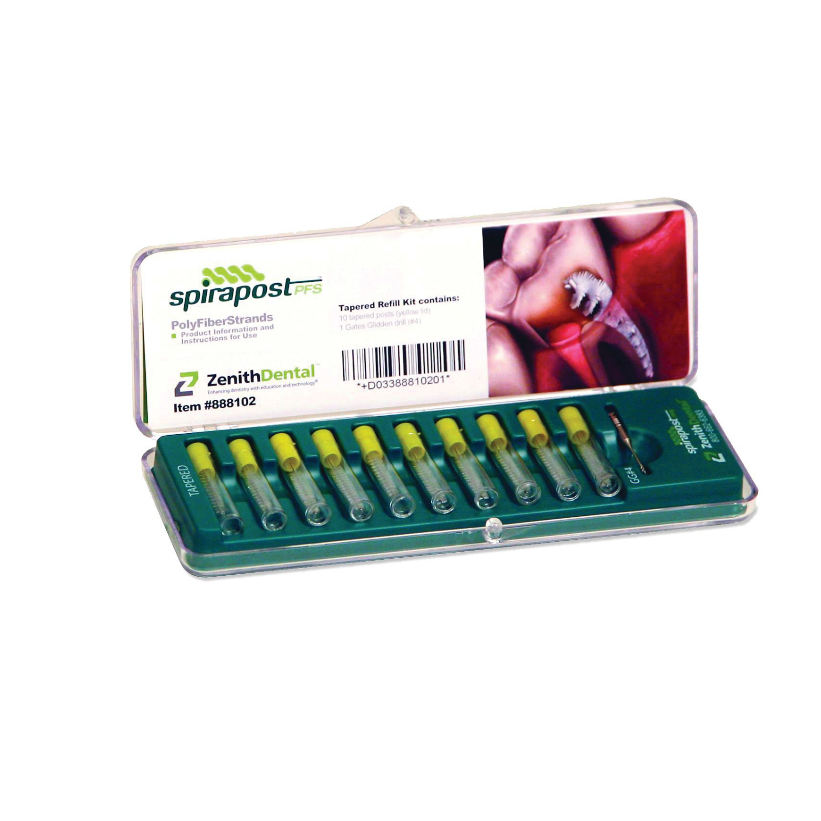 SpiraPost PFS Intro Kit (15630)