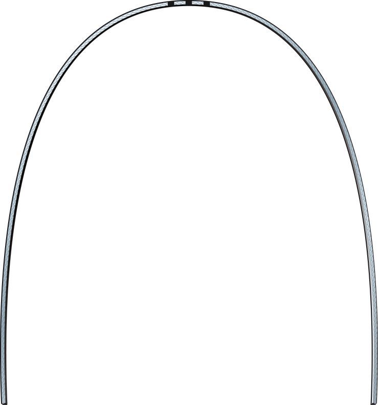 Equire Preformed Ideal Arches, Rectangular, Arch Form: American Style ...
