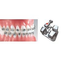 Bionic Bracket – Roth V-Slot RX 10 Packs (20256)