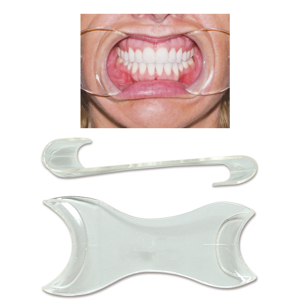 Photo Cheek Retractors Double Ended (1/pk) (20874)