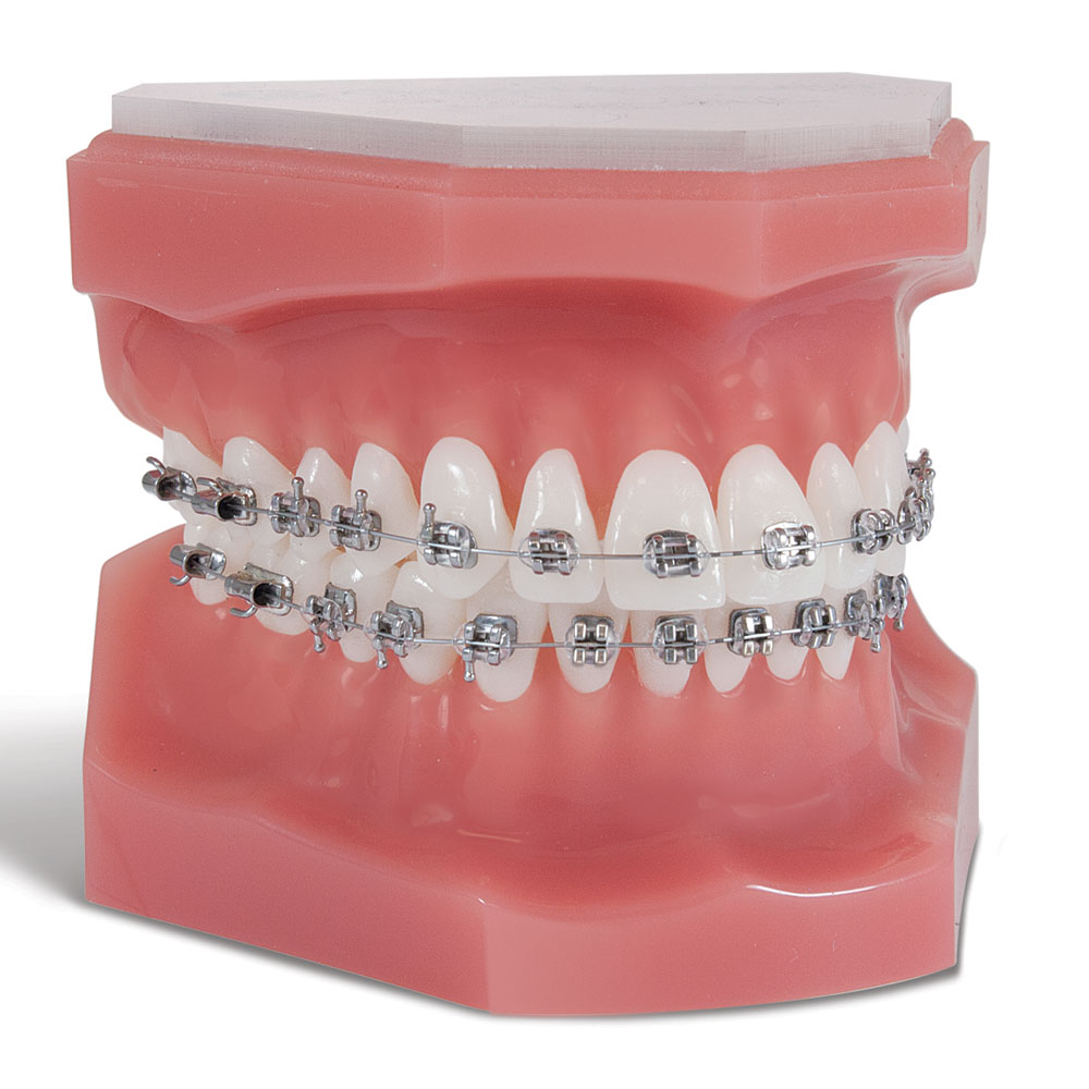 Typodont – Pinnacle (25210)