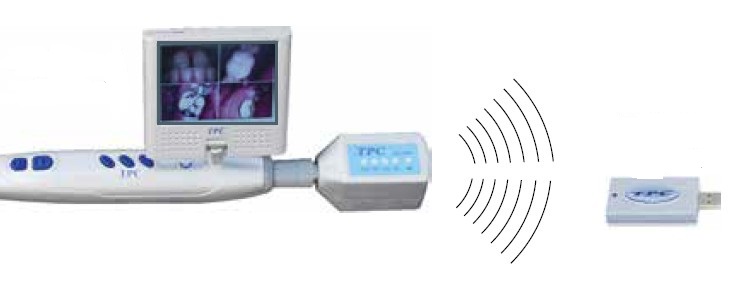 TPC Advance Cam Intraoral Camera Optionals (Cordless USB Camera System ...