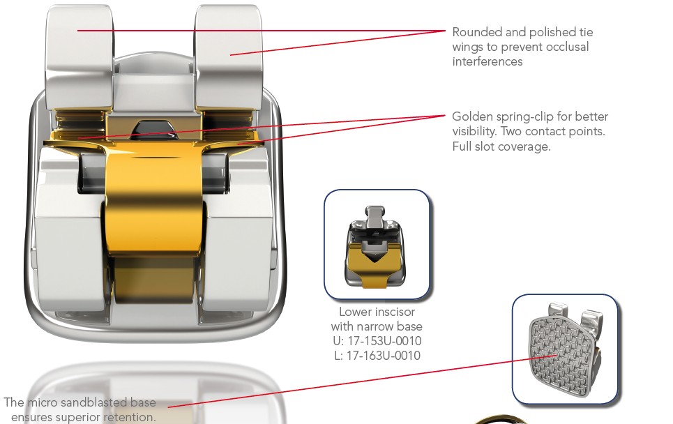 Experience Self-Ligating Bracket System (5310)