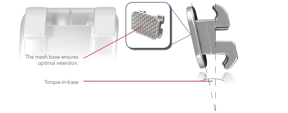 Legacy Brackets - Roth Type (5360)